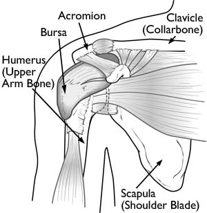 Shoulder Impingement - Rotator Cuff Tendinitis - Omaha Shoulder Surgery